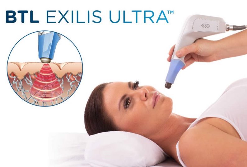 Experience the power of Exilis Ultra 360 — Sense of Touch